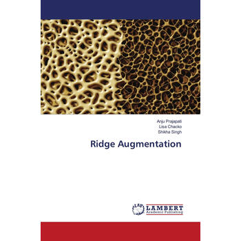 Ridge Augmentation