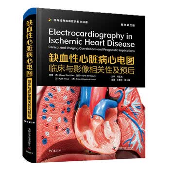 缺血性心脏病心电图原书第2二版临床与影像相关性及预后米格尔菲奥尔萨拉国际经典心血管内科学译著中国科学