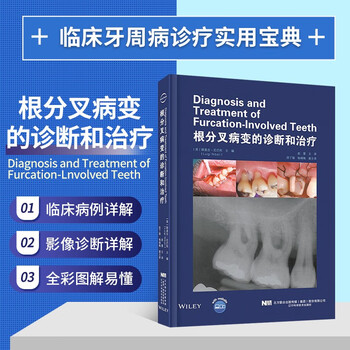 根分叉病变的诊断和治疗 口腔医学书籍 磨牙及前磨牙根分叉病变治疗方法 根分叉病变治疗程序 牙周牙髓修复难题解读 牙齿修复后遗症临床解读 口腔疾病诊断技术 口腔科医师实用工具书
