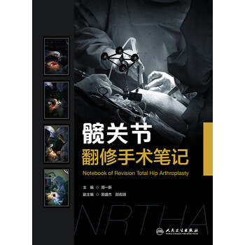 髋关节翻修手术笔记