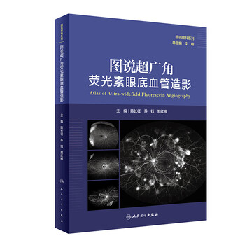 图说超广角荧光素眼底血管造影（图说眼科系列）