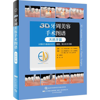 3D牙周美容手术图谱 天然牙篇