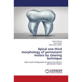 Apical one third morphology of permanent molars