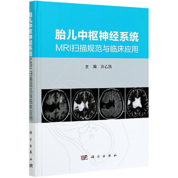 胎儿中枢神经系统MRI扫描规范与临床应用(精)