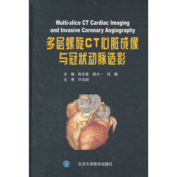 多层螺旋CT心脏成像与冠状动脉造影【正版图书】