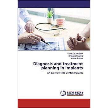 Diagnosis and treatment planning in implants