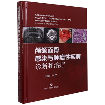 颅颌面骨感染与肿瘤性疾病：诊断和治疗