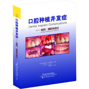 口腔种植并发症:病因预防和治疗