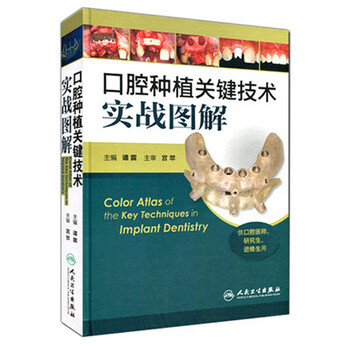 口腔种植关键技术实战图解【正版图书】