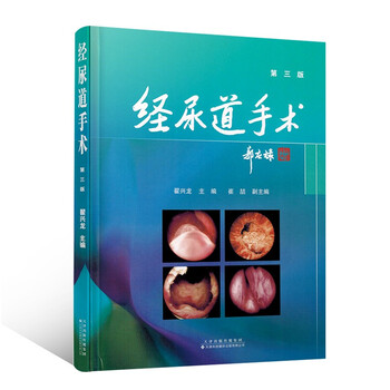 经尿道手术