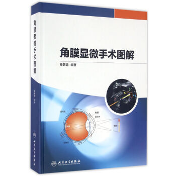 角膜显微手术图解精
