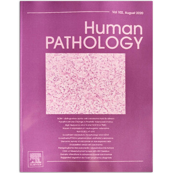 【单期可选】Human Pathology 人体病理学医学杂志 2019年1月刊 英文英语杂志 2020年8月刊