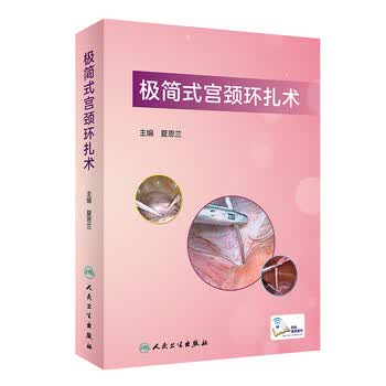 极简式宫颈环扎术（配增值）