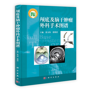 正版图书 颅底及脑干肿瘤外科手术图谱 张力伟,张俊廷,吴震,贾桂军 科学出版社 9787030339