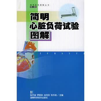 简明心脏负荷试验图解
