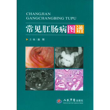 常见肛肠病图谱 赵刚 人民军医出版社 9787509176436