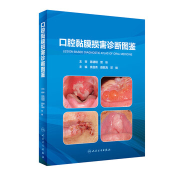 口腔黏膜损害诊断图鉴 正版