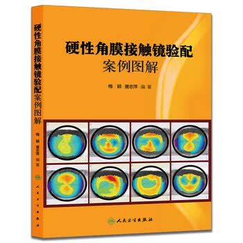 慢性角膜接触镜艾力图解【正版图书】