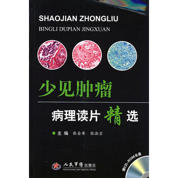 少见肿瘤病理读片精选【正版图书】