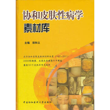 协和皮肤性病学素材库