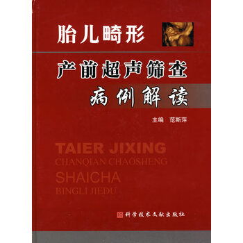 胎儿畸形产前超声筛查病例解读 范斯萍
