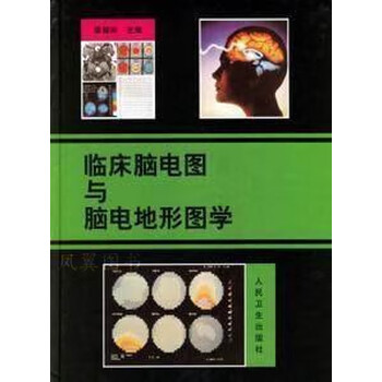 临床脑电图与脑电地形图学 谭郁玲 人民卫生出版社