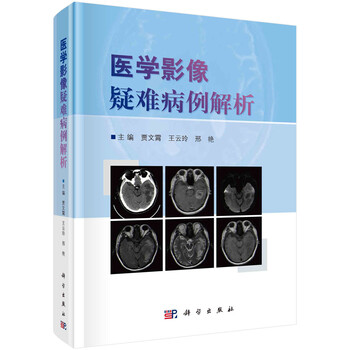 医学影像疑难病例解析