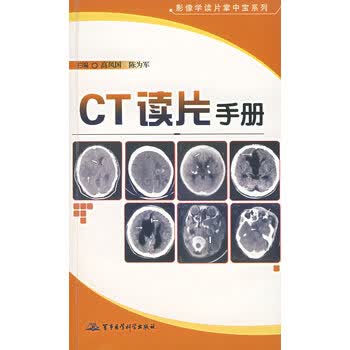 CT读片手册 高凤丽、陈为军