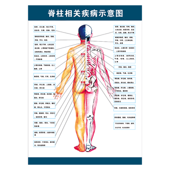 中医宣传画挂图中药配伍禁忌歌十八反十九畏歌脊柱图墙贴画WSA WSA37 脊柱相关疾病示意图 60*40厘米 覆膜防水PP贴纸