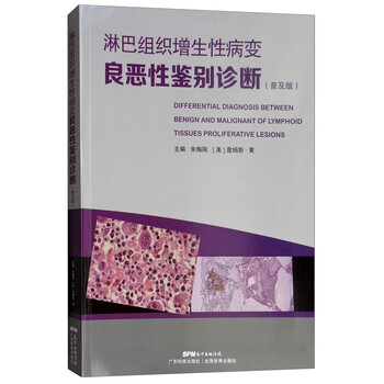 淋巴组织增生性病变良恶性鉴别诊断（普及版）