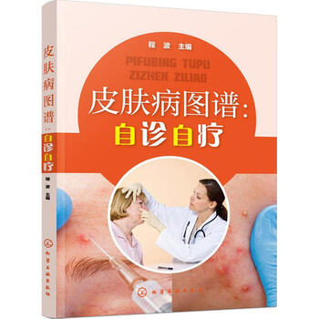 皮肤病图谱:自诊自疗