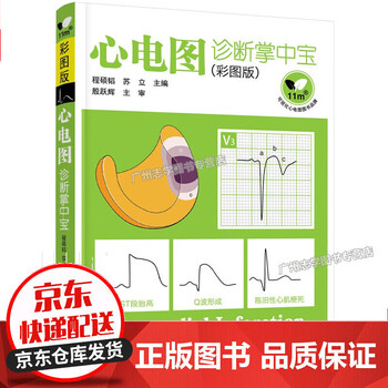 心电图诊断掌中宝（彩图版）（全彩图解） 正版 正版