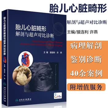 包邮胎儿心脏畸形 解剖与超声对比诊断 人民卫生出版 主编接连利 许燕 内科学心脏病学