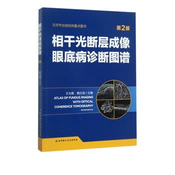 相干光断层成像眼底病诊断图谱(第2版)(精)