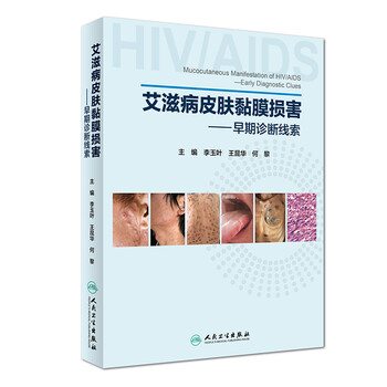 艾滋病皮肤黏膜损害·早期诊断线索