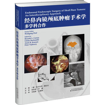 经鼻内窥镜颅底肿瘤手术学 多学科合作