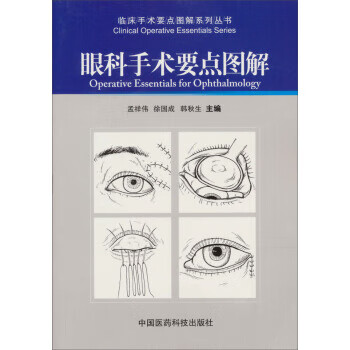 眼科手术要点图解【正版图书】