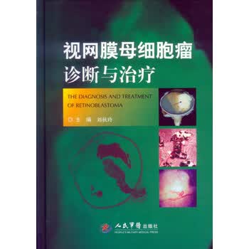 视网膜母细胞瘤诊断与 刘秋玲