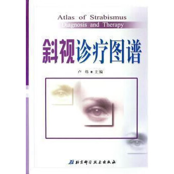 斜视诊疗图谱 卢炜 北京科学技术出版社