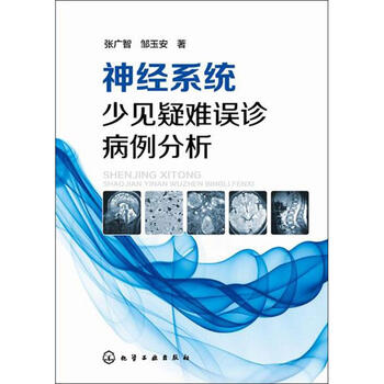 神经系统疑难误诊病例分析