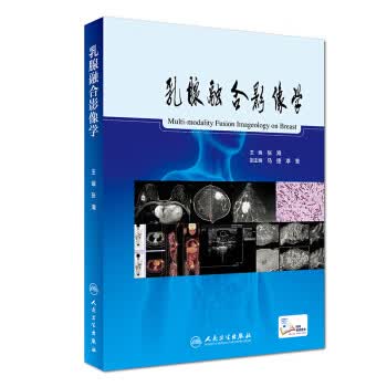 乳腺融合影像学