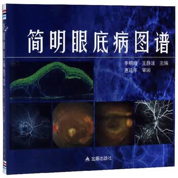 正版 简明眼底病图谱9787508292489