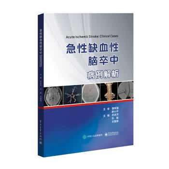 急性缺血性脑卒中病例解析