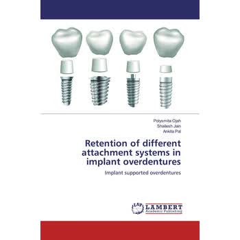 Retention of different attachment systems in imp