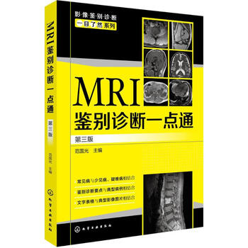 MRI鉴别诊断一点通 范国光 化学工业出版社