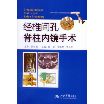 经椎间孔脊柱内镜手术