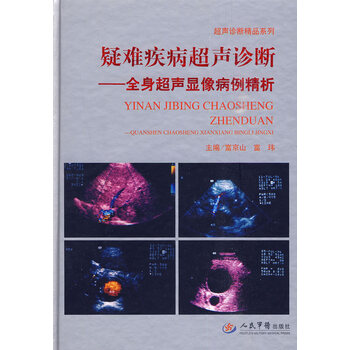 疑难疾病超声诊断-全身超声显病例精析 医学 富京山，富玮主编 人民军医出版社       97875