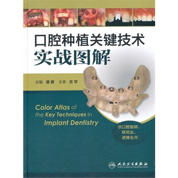 口腔种植关键技术实战图解