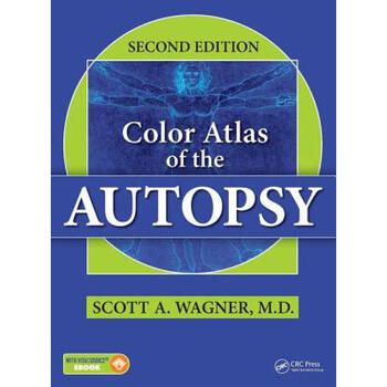 Color Atlas of the Autopsy