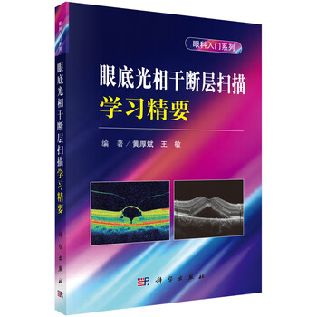 xj眼底光相干断层扫描学习精要 医学 书籍